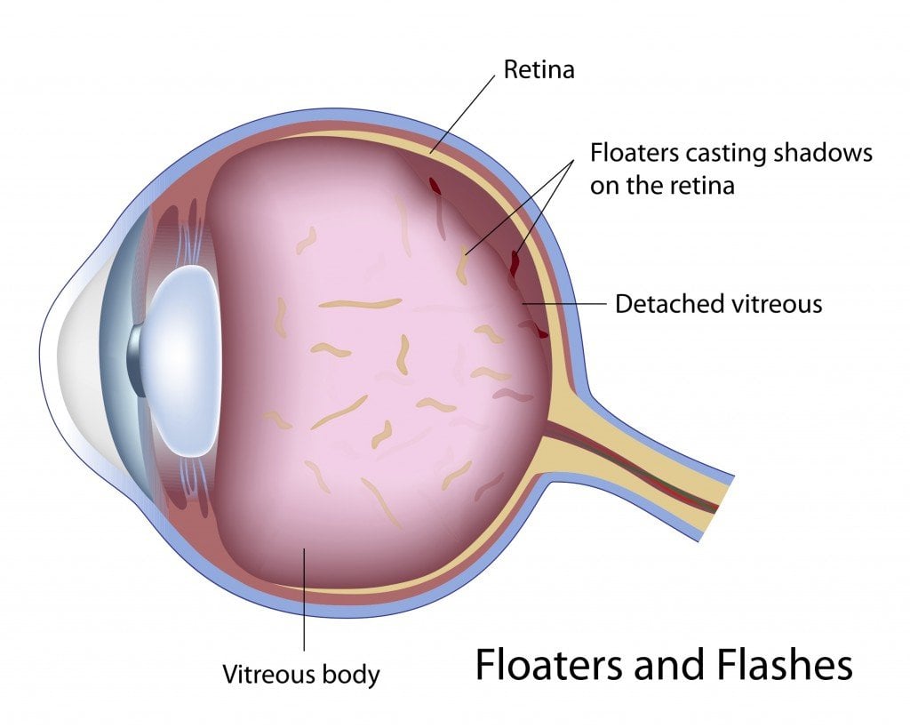 What Are Those Floating Things In Your Eyes? » ScienceABC