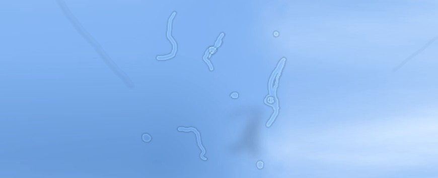 What Are Those Floating Things In Your Eyes? » ScienceABC