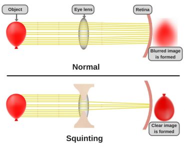 Why Squinting Helps Us See Better? » ScienceABC