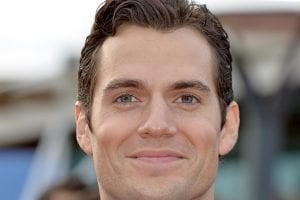 What Is Heterochromia? Why Does It Occur?