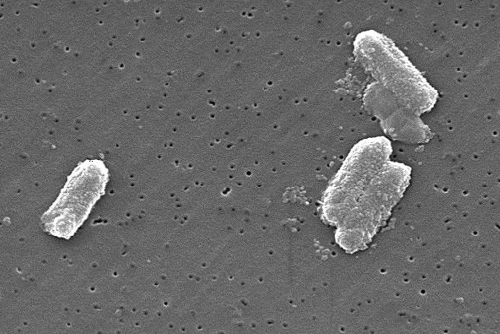 Citrobacter Freundii: Definition, Characteristics And Symptoms