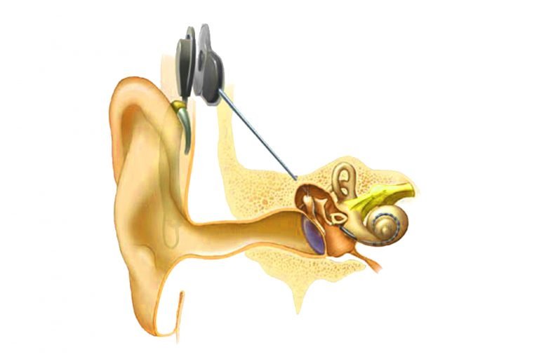 Brain Computer Interface (BCI): Technology, Types And Applications