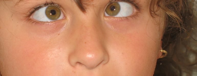 Science ABC » Page 108 of 262 » Science Explained In Simple Words