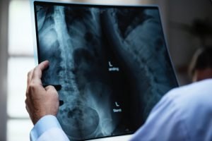 X Ray: Definition, Properties, History And Applications