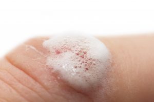 Why does hydrogen peroxide bubble when it is poured on a skin cut?